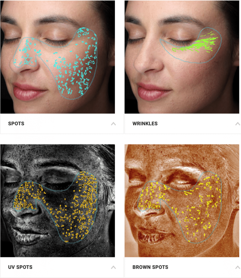 Visia Skin Analysis | Solihull Medical Cosmetic Clinic
